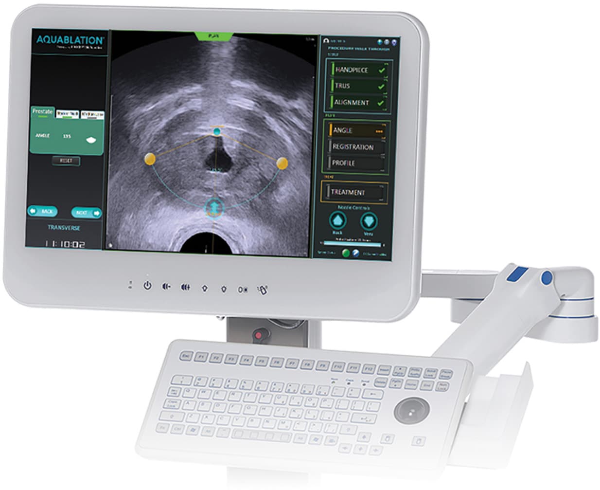 Aquablation Therapy Information for Healthcare Providers | PROCEPT ...